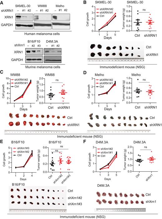 Targeting RNA Exonuclease XRN1 Potentiates Efficacy of Cancer ...