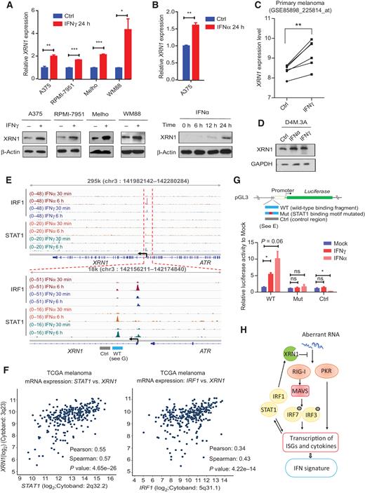 Targeting RNA Exonuclease XRN1 Potentiates Efficacy of Cancer ...