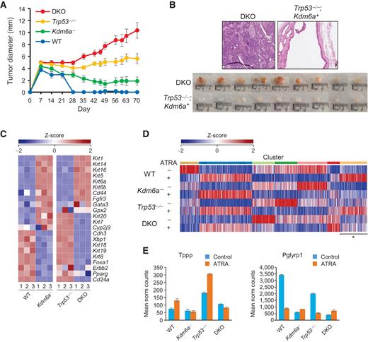 KDM6A Loss Triggers an Epigenetic Switch That Disrupts Urothelial ...
