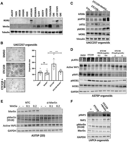 WNT5a Signaling through ROR2 Activates the Hippo Pathway to Suppress ...