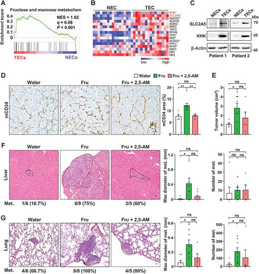 Fructose Metabolism in Tumor Endothelial Cells Promotes Angiogenesis by ...