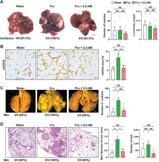 Fructose Metabolism in Tumor Endothelial Cells Promotes Angiogenesis by ...