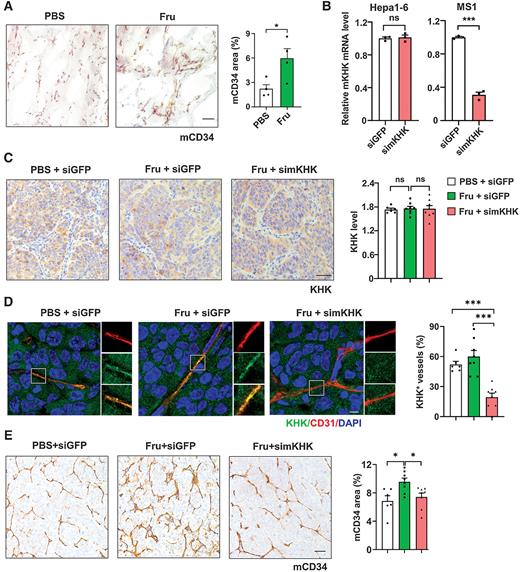 Fructose Metabolism in Tumor Endothelial Cells Promotes Angiogenesis by ...