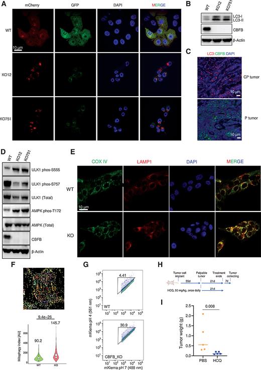 Dysregulation of Mitochondrial Translation Caused by CBFB Deficiency ...