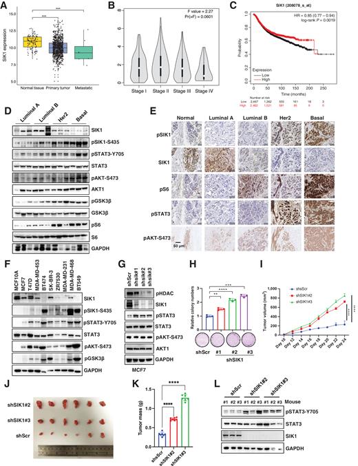 AKT Blocks SIK1-Mediated Repression of STAT3 to Promote Breast ...