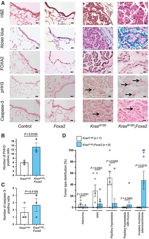 FOXA2 Cooperates with Mutant KRAS to Drive Invasive Mucinous ...