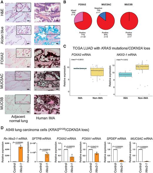 FOXA2 Cooperates with Mutant KRAS to Drive Invasive Mucinous ...