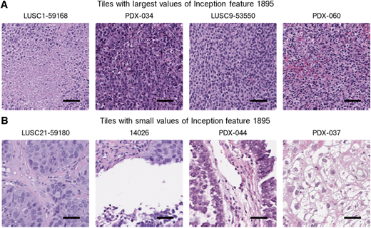 A Pan-Cancer Patient-Derived Xenograft Histology Image Repository with ...