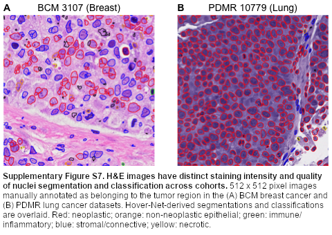 A Pan-Cancer Patient-Derived Xenograft Histology Image Repository with ...
