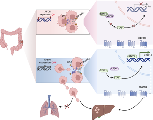 AFDN Deficiency Promotes Liver Tropism of Metastatic Colorectal Cancer ...