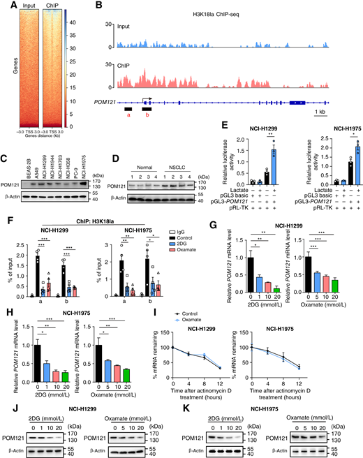 H3K18 Lactylation Potentiates Immune Escape of Non–Small Cell Lung ...