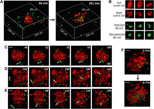 Deep Learning–Based 3D Single-Cell Imaging Analysis Pipeline Enables ...