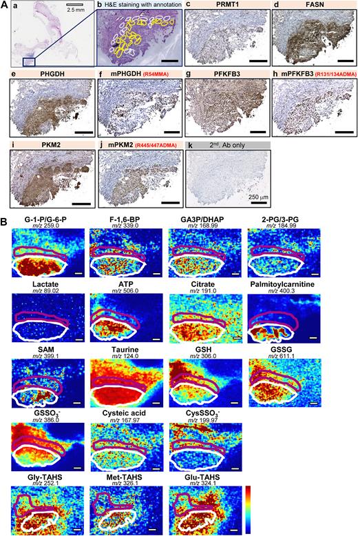 PRMT1 Sustains De Novo Fatty Acid Synthesis by Methylating PHGDH to ...
