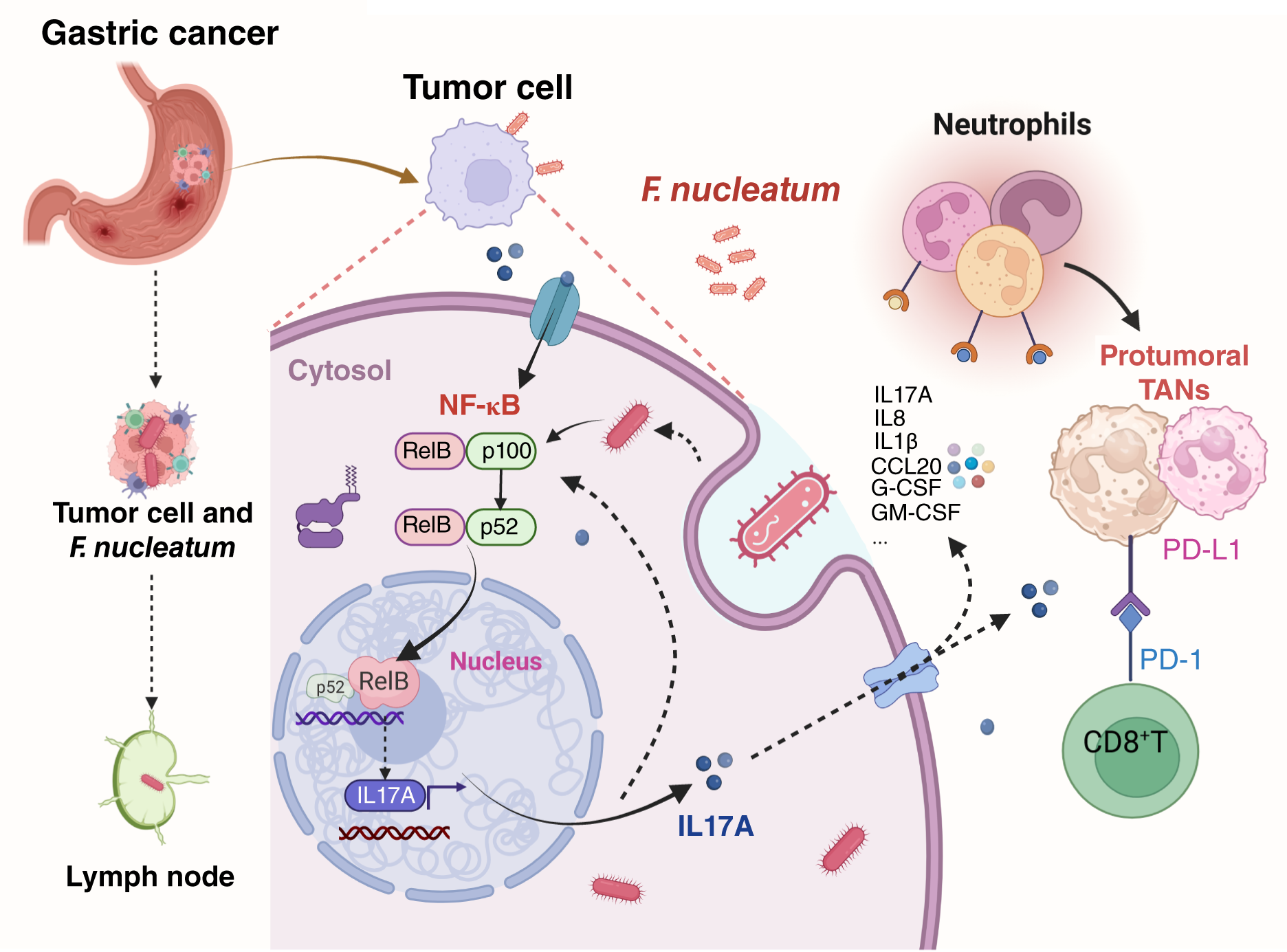 Intratumoral Fusobacterium nucleatum Recruits Tumor-Associated ...