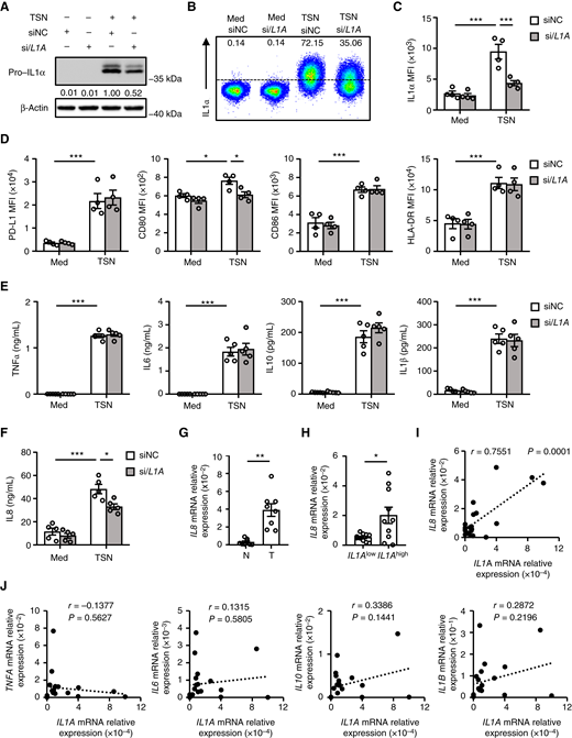 Intracellular IL1α in Peritumoral Monocytes Induces IL8 Production and ...