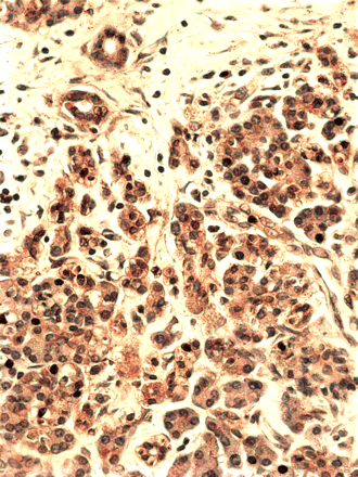 Identification of Human Uroplakin II Promoter and Its Use in the ...