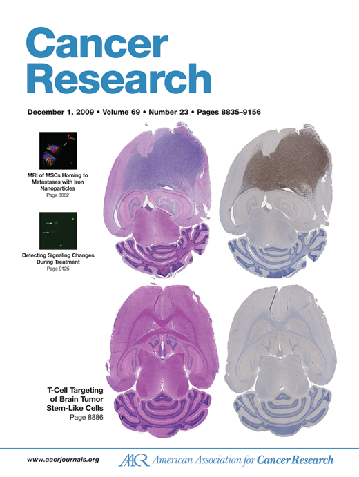 Human rRNA Gene Clusters Are Recombinational Hotspots in Cancer ...
