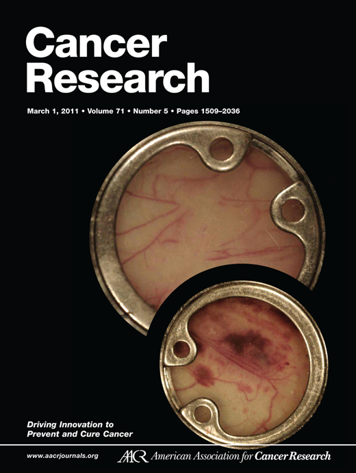 Ulcerative Colitis–Associated Colorectal Cancer Arises in a Field of ...