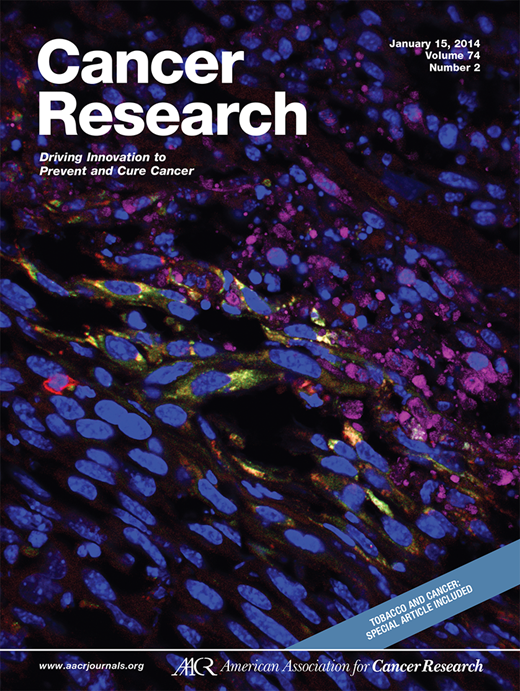 IRP2 Regulates Breast Tumor Growth | Cancer Research | American ...