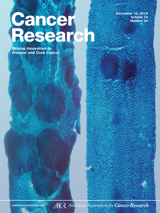 Homeoprotein Six2 Promotes Breast Cancer Metastasis via Transcriptional ...