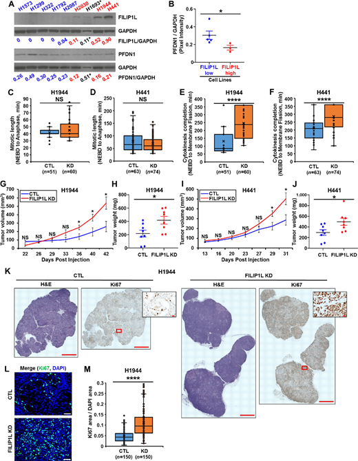 Smoking-associated Downregulation of FILIP1L Enhances Lung ...