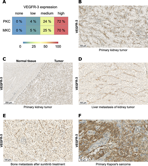 Targeting Tumor Angiogenesis with the Selective VEGFR-3 Inhibitor ...