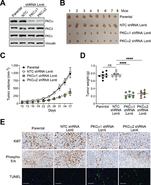 Protein Kinase C Alpha is a Central Node for Tumorigenic ...