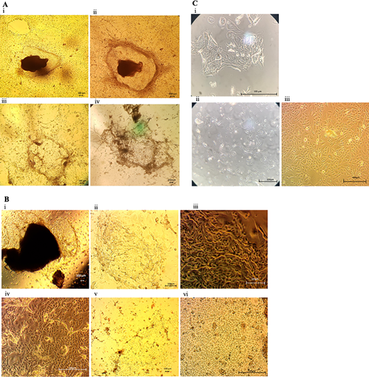 Expanding the Prostate Cancer Cell Line Repertoire with ACRJ-PC28, an ...
