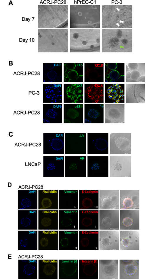 Expanding the Prostate Cancer Cell Line Repertoire with ACRJ-PC28, an ...