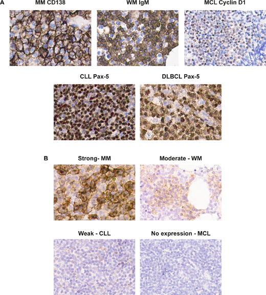 Redirecting T-cell Activity with Anti-BCMA/Anti-CD3 Bispecific ...