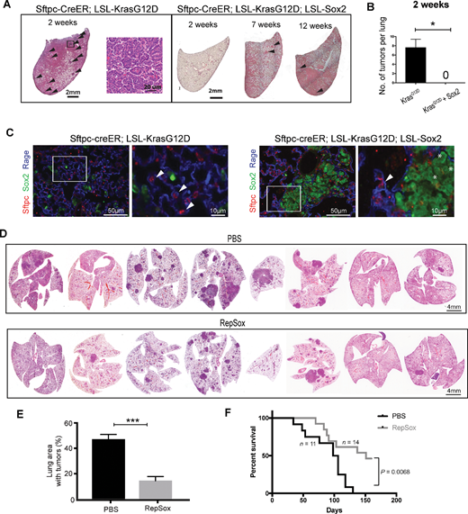 Activation of KrasG12D in Subset of Alveolar Type II Cells Enhances ...