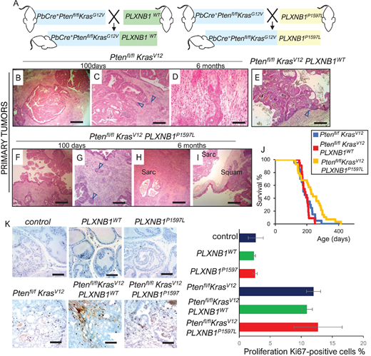 Plexin-B1 Mutation Drives Metastasis in Prostate Cancer Mouse Models ...