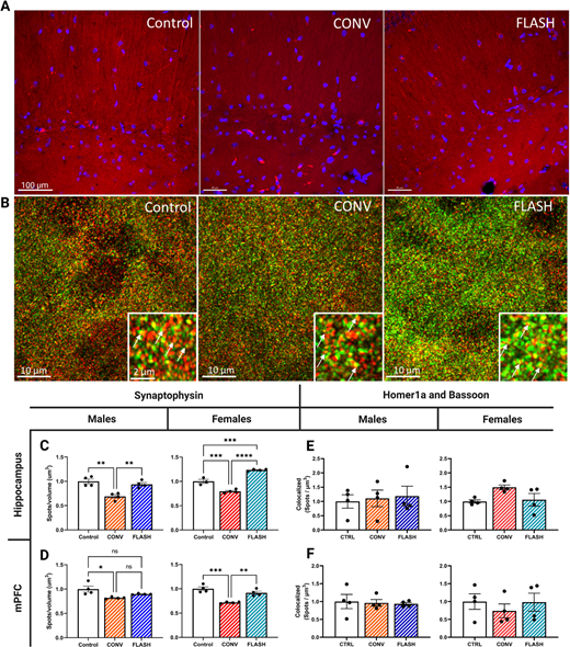Uncovering the Protective Neurologic Mechanisms of Hypofractionated ...