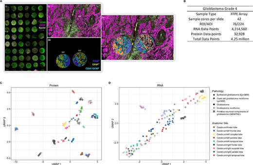 Ultra High-plex Spatial Proteogenomic Investigation of Giant Cell ...