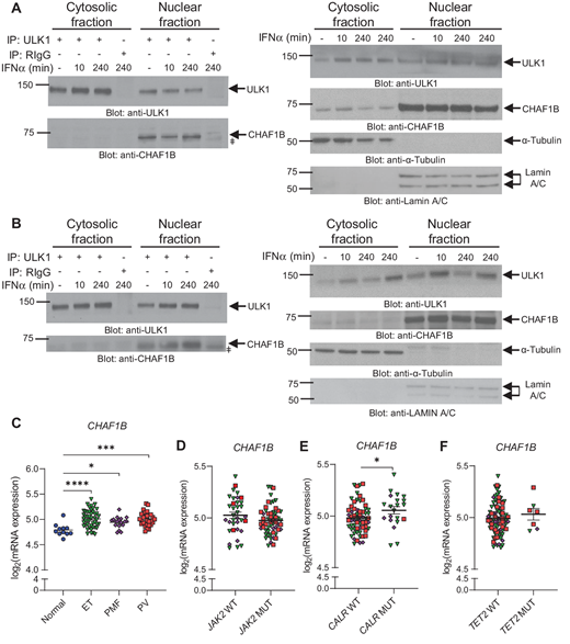 Targeting CHAF1B Enhances IFN Activity against Myeloproliferative ...