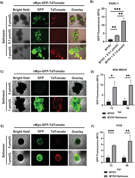 Nuclear Export Inhibitor Selinexor Enhances Oncolytic Myxoma Virus ...