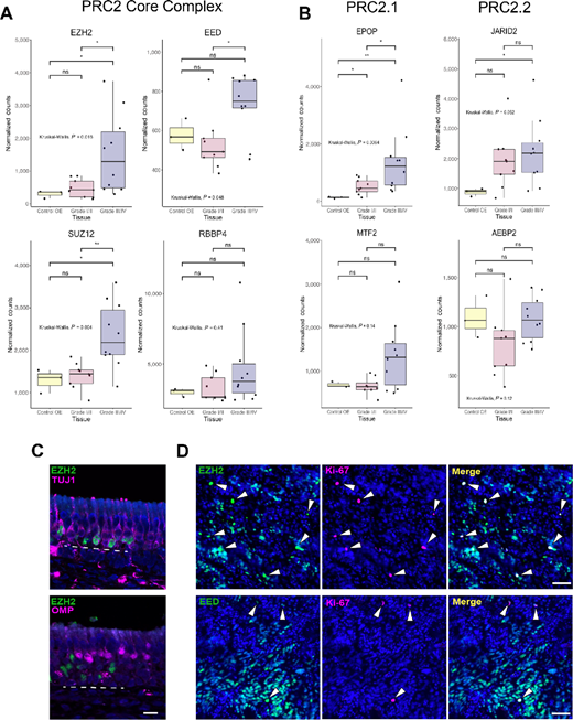 Deconstructing Olfactory Epithelium Developmental Pathways in Olfactory ...