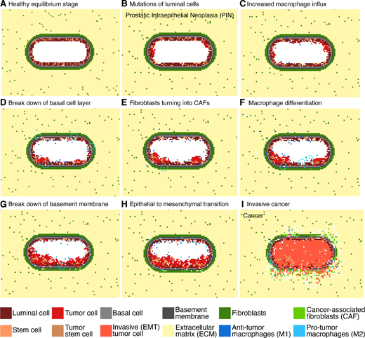 Exploring the Onset and Progression of Prostate Cancer through a ...