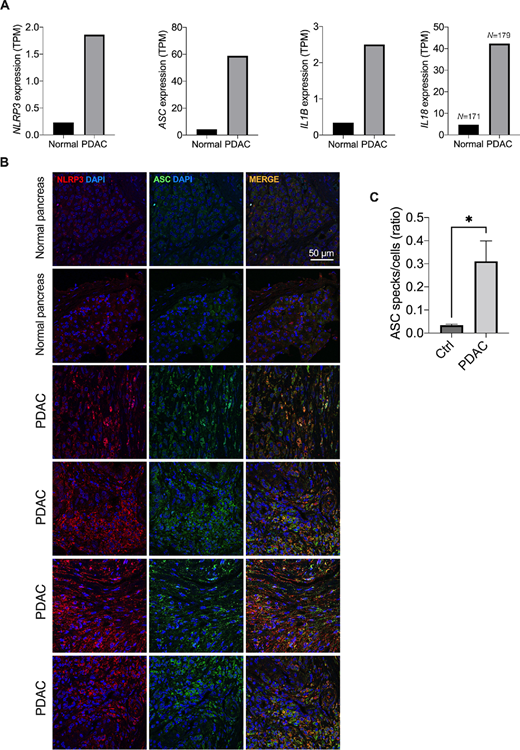 Pancreatic Ductal Adenocarcinoma Cells Regulate NLRP3 Activation to ...