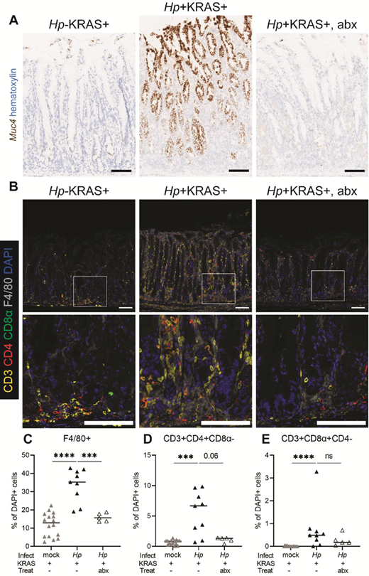 Single-cell Profiling Uncovers a Muc4-Expressing Metaplastic Gastric ...