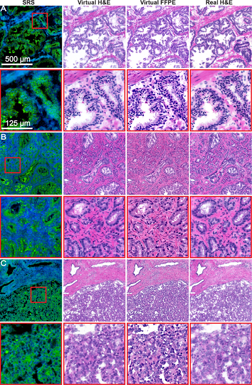 Accelerating Cancer Histopathology Workflows with Chemical Imaging and ...