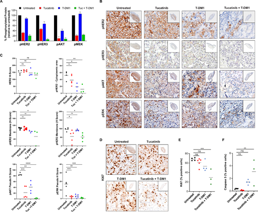 HER2-Selective and Reversible Tyrosine Kinase Inhibitor Tucatinib ...