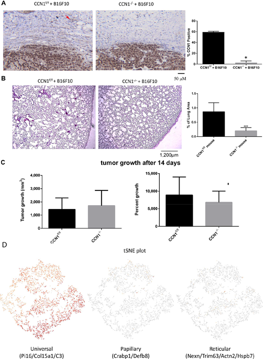 Cancer-associated Fibroblast–specific Expression of the Matricellular ...