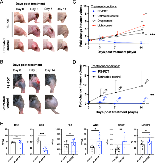 Nanoparticle-mediated Photodynamic Therapy as a Method to Ablate Oral ...