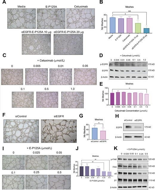 Antibody–Drug Conjugate αEGFR-E-P125A Reduces Triple-negative Breast ...