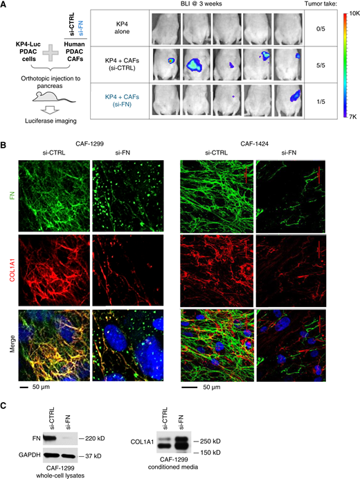 Targeting Pancreatic Cancer Cell Stemness by Blocking Fibronectin ...