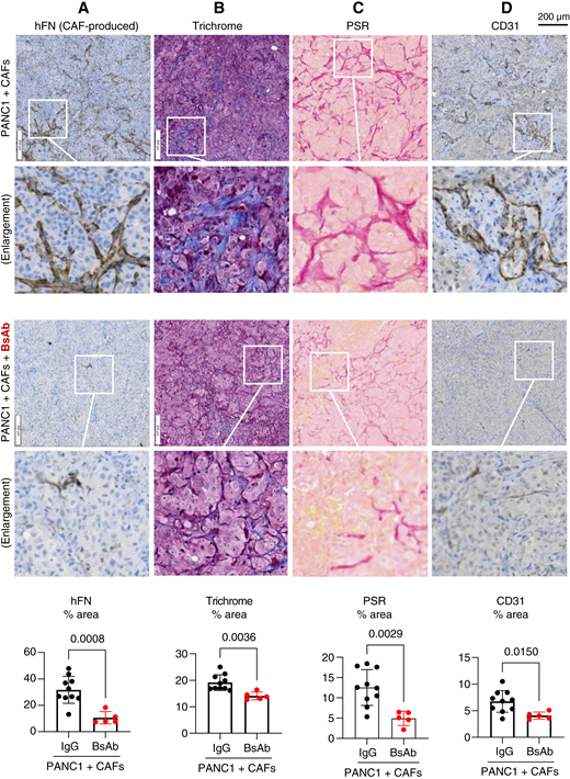 Targeting Pancreatic Cancer Cell Stemness by Blocking Fibronectin ...