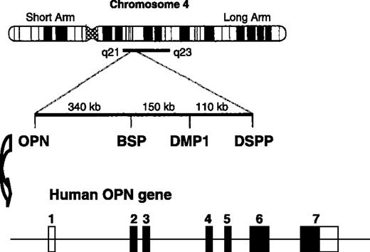 The Role of Osteopontin in Tumor Progression and Metastasis in Breast ...