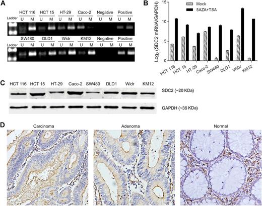 Stool DNA Test of Methylated Syndecan-2 for the Early Detection of ...