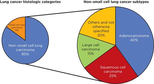 Cancer Progress and Priorities: Lung Cancer | Cancer Epidemiology ...